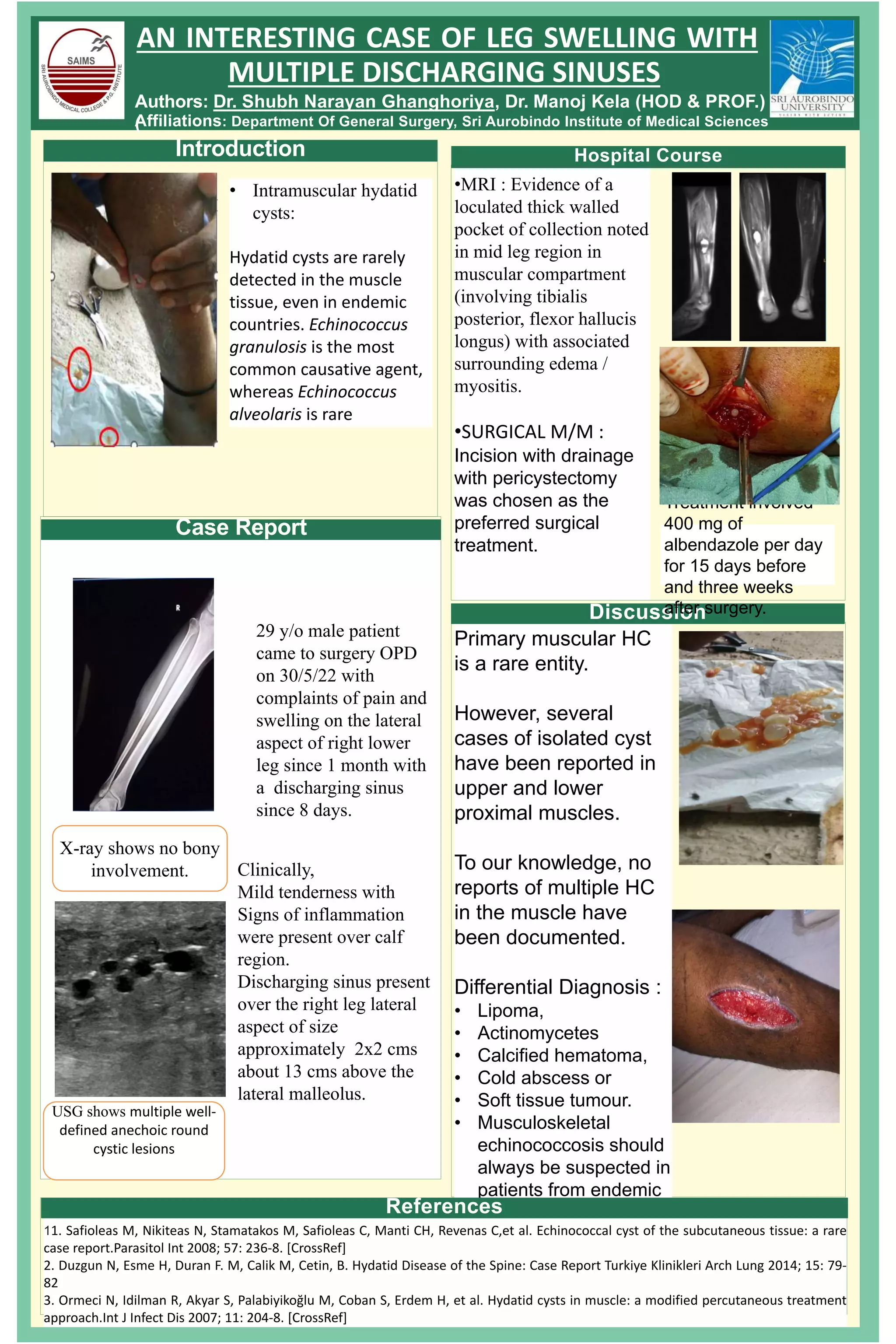 hydatid poster.pptx