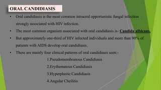 Oral Manifestation of HIV including premalignant and opportunistic ...