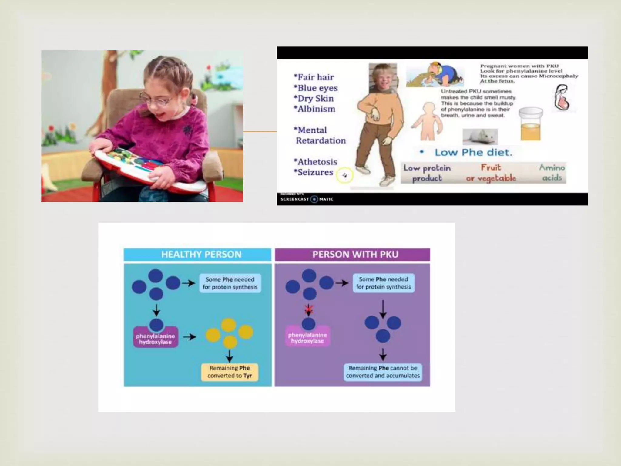 Single Gene Disorder/ Mendalian Disorder - Shumaila Riaz | PPTX