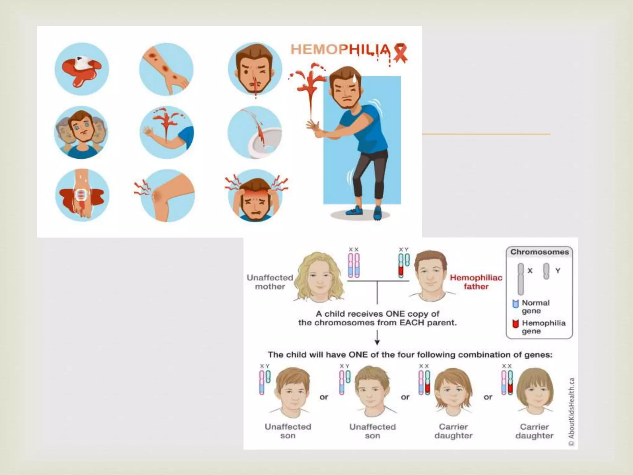 Single Gene Disorder/ Mendalian Disorder - Shumaila Riaz | PPTX