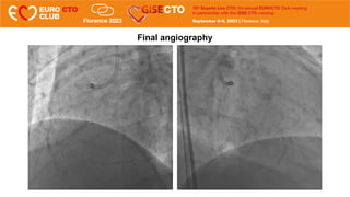 Sunsuke Matsuno: Intracoronary imaging guidance in CTO practice | PDF ...