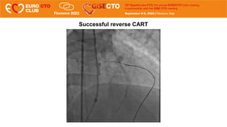 Sunsuke Matsuno: Intracoronary imaging guidance in CTO practice | PDF ...