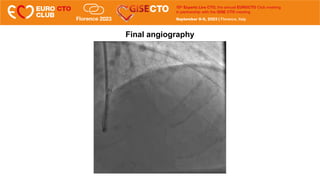 Sunsuke Matsuno: Intracoronary imaging guidance in CTO practice | PDF ...