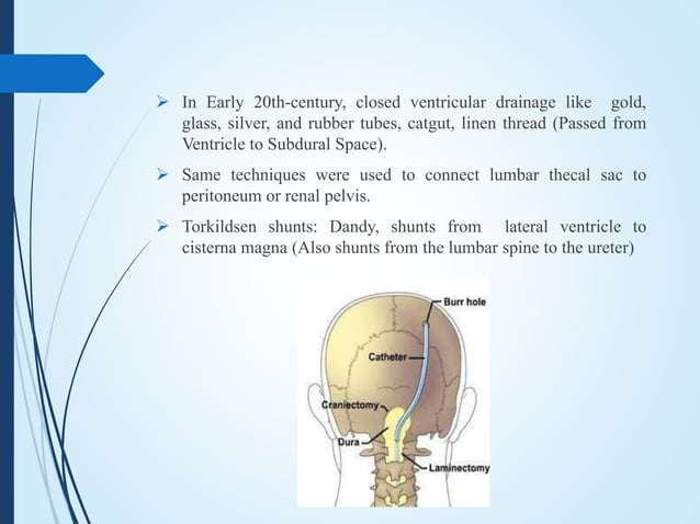 Shunt Surgery | PPTX | Brain and Nervous System Disorders | Diseases ...