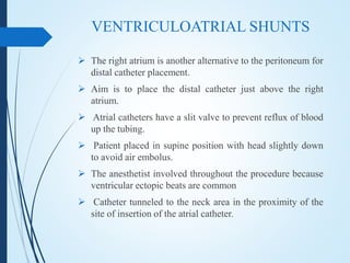 Shunt Surgery | PPTX