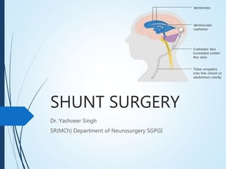 Shunt Surgery | PPT