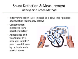 shunt calculation final in structural heart disease | PPT