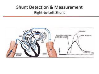 shunt calculation final in structural heart disease | PPT