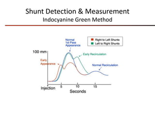 shunt calculation final in structural heart disease | PPT
