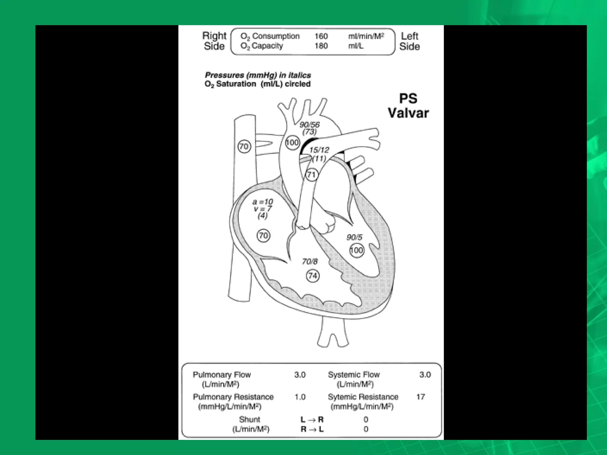 Shunt Detection And Quantification Ppt