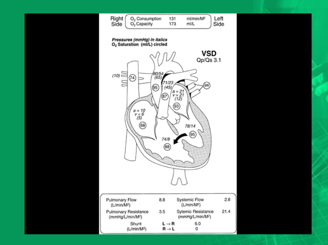 Shunt Detection And Quantification | PPT