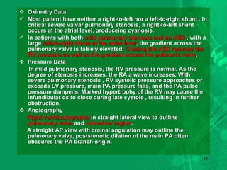 Shunt Detection And Quantification | PPT