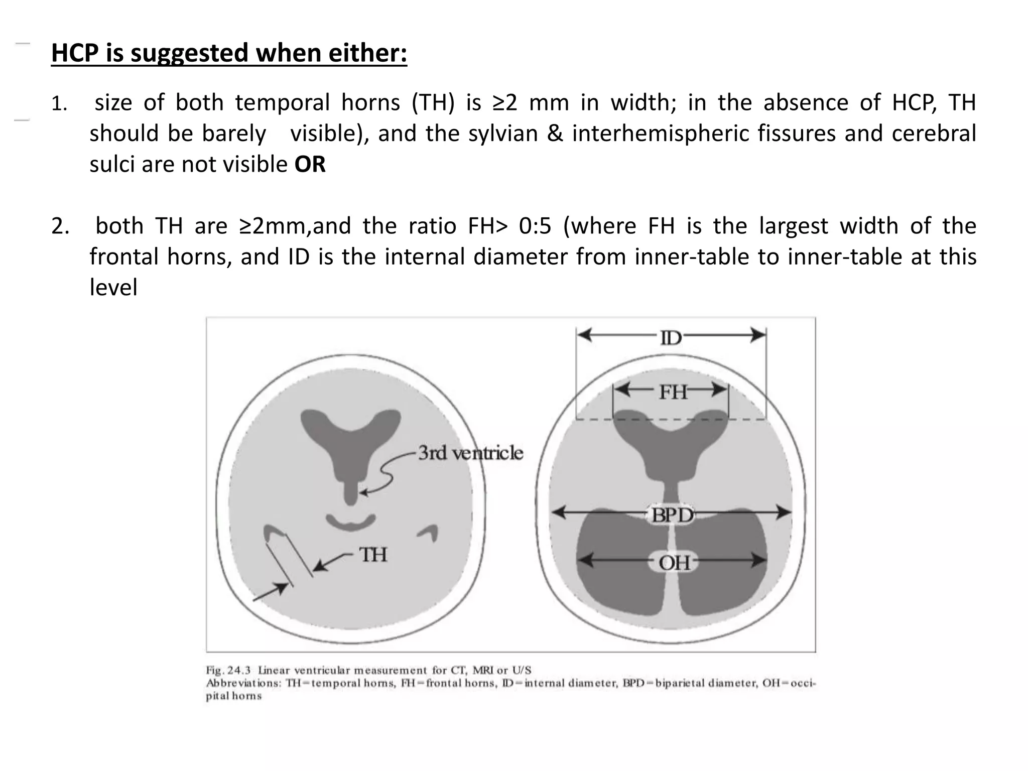 Shunt for hydrocephalus | PPTX