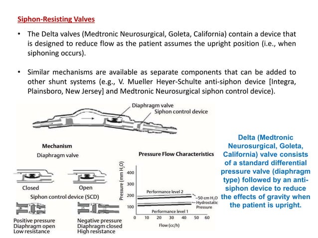 Shunt for hydrocephalus | PPTX | Brain and Nervous System Disorders ...