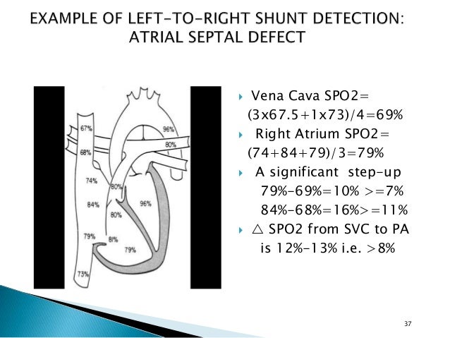 Shunt quantification