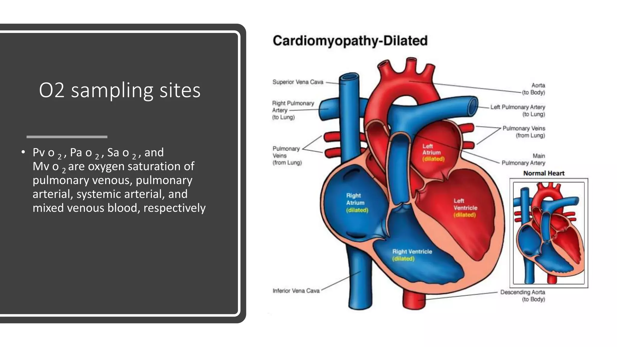 Shunt quantification | PPT