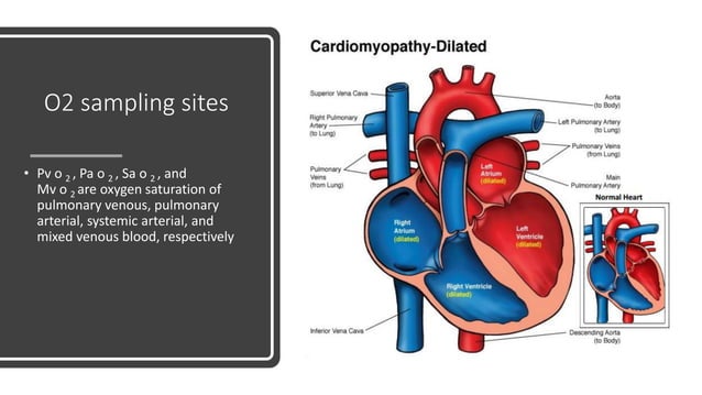 Shunt quantification | PPT