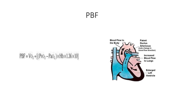 Shunt quantification | PPT