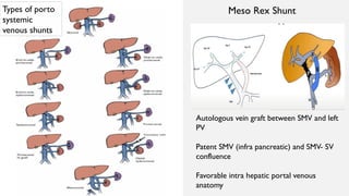 Shunt surgery for portal hypertension.pptx