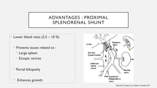 Shunt surgery for portal hypertension.pptx