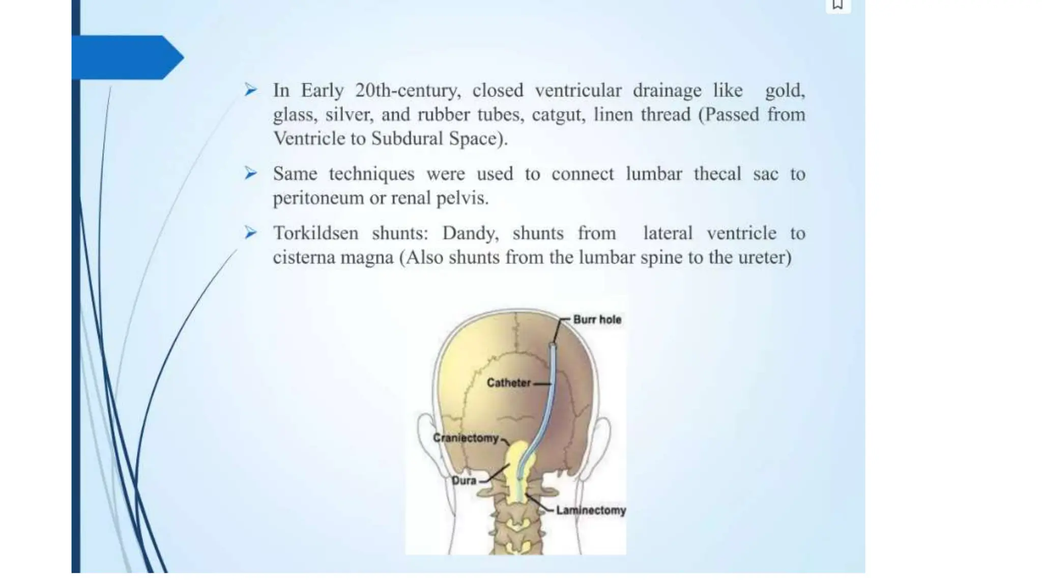 CSF diversion procedure VP shunt surgery.pptx | Brain and Nervous ...