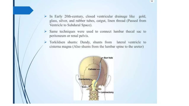 CSF diversion procedure VP shunt surgery.pptx