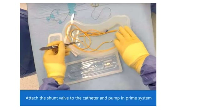 CSF diversion procedure VP shunt surgery.pptx