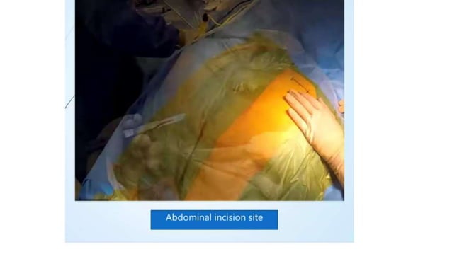 CSF diversion procedure VP shunt surgery.pptx