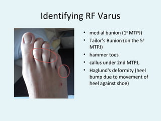 Pudendal Neuralgia and Lower Extremity (Feet) Biomechanics - ICS 2011 ...