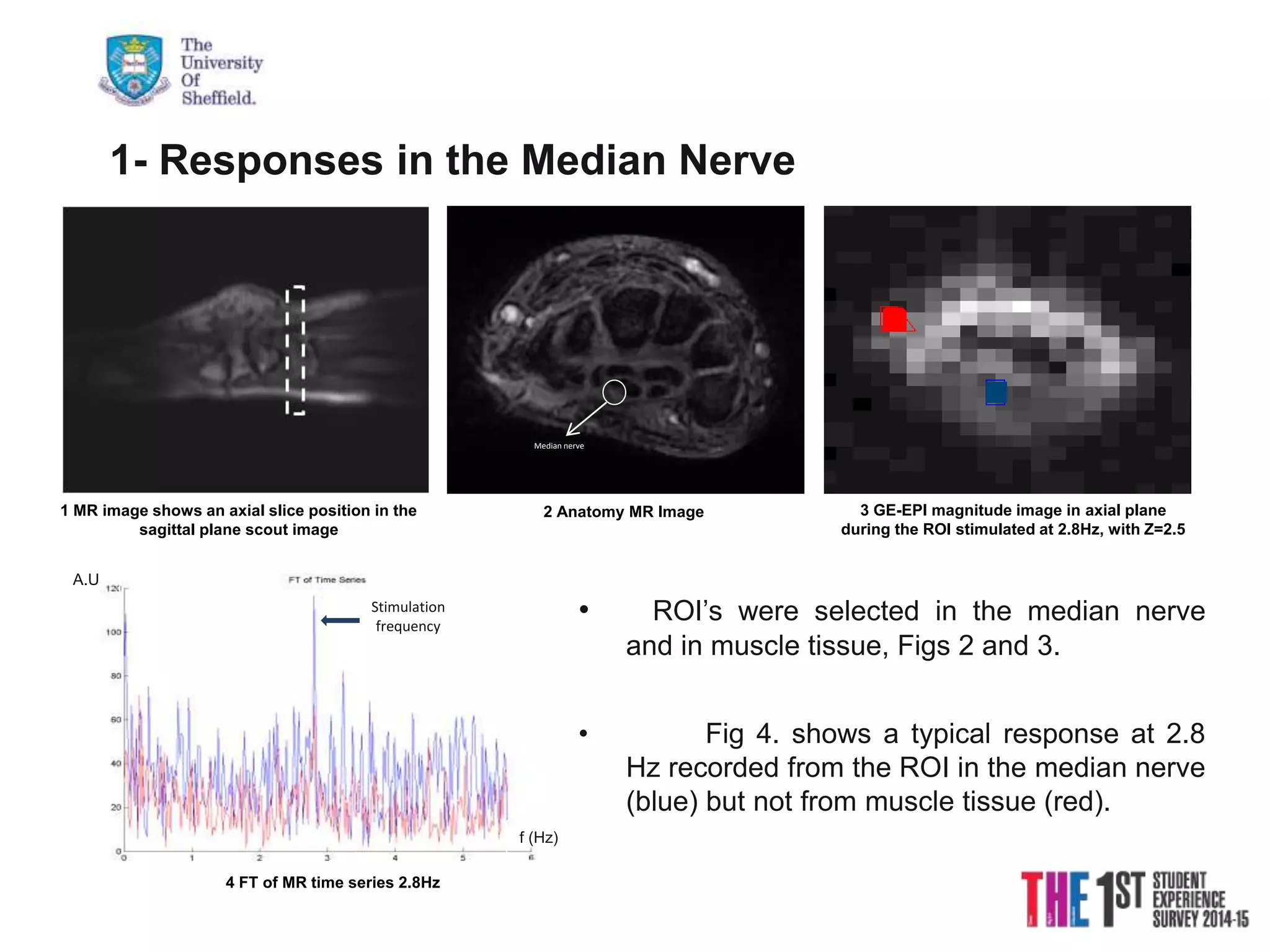 Advance fMRI (Fast fMRI) | PPTX