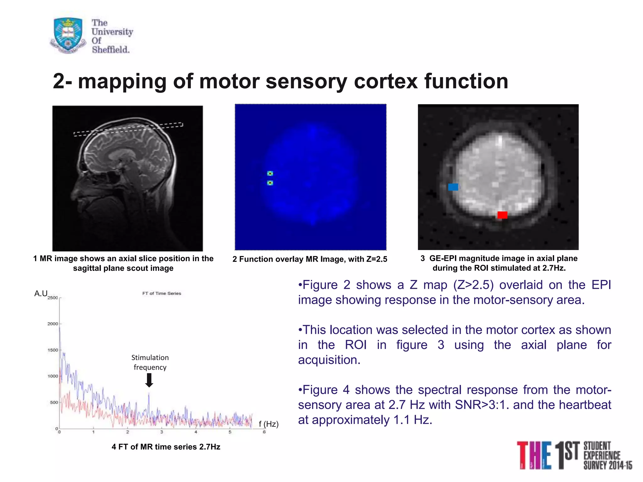Advance fMRI (Fast fMRI) | PPTX