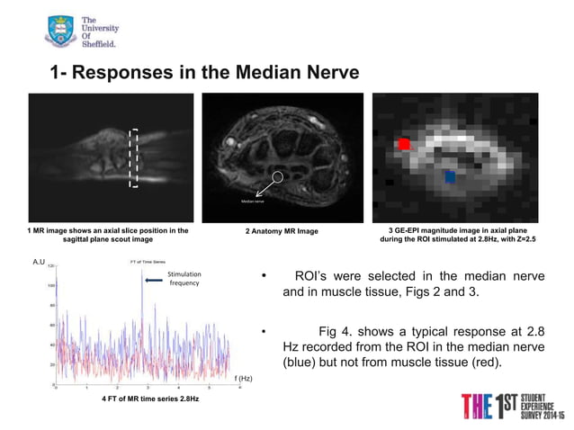 Advance fMRI (Fast fMRI) | PPTX | Brain and Nervous System Disorders | Diseases and Conditions
