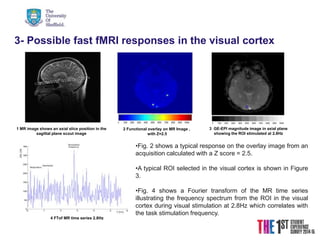 Advance fMRI (Fast fMRI) | PPTX | Brain and Nervous System Disorders ...