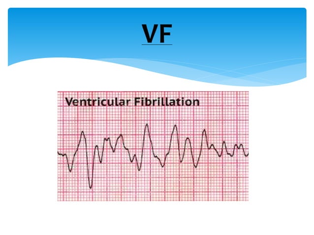 Shweta code blue | PPTX | First Aid | Injuries