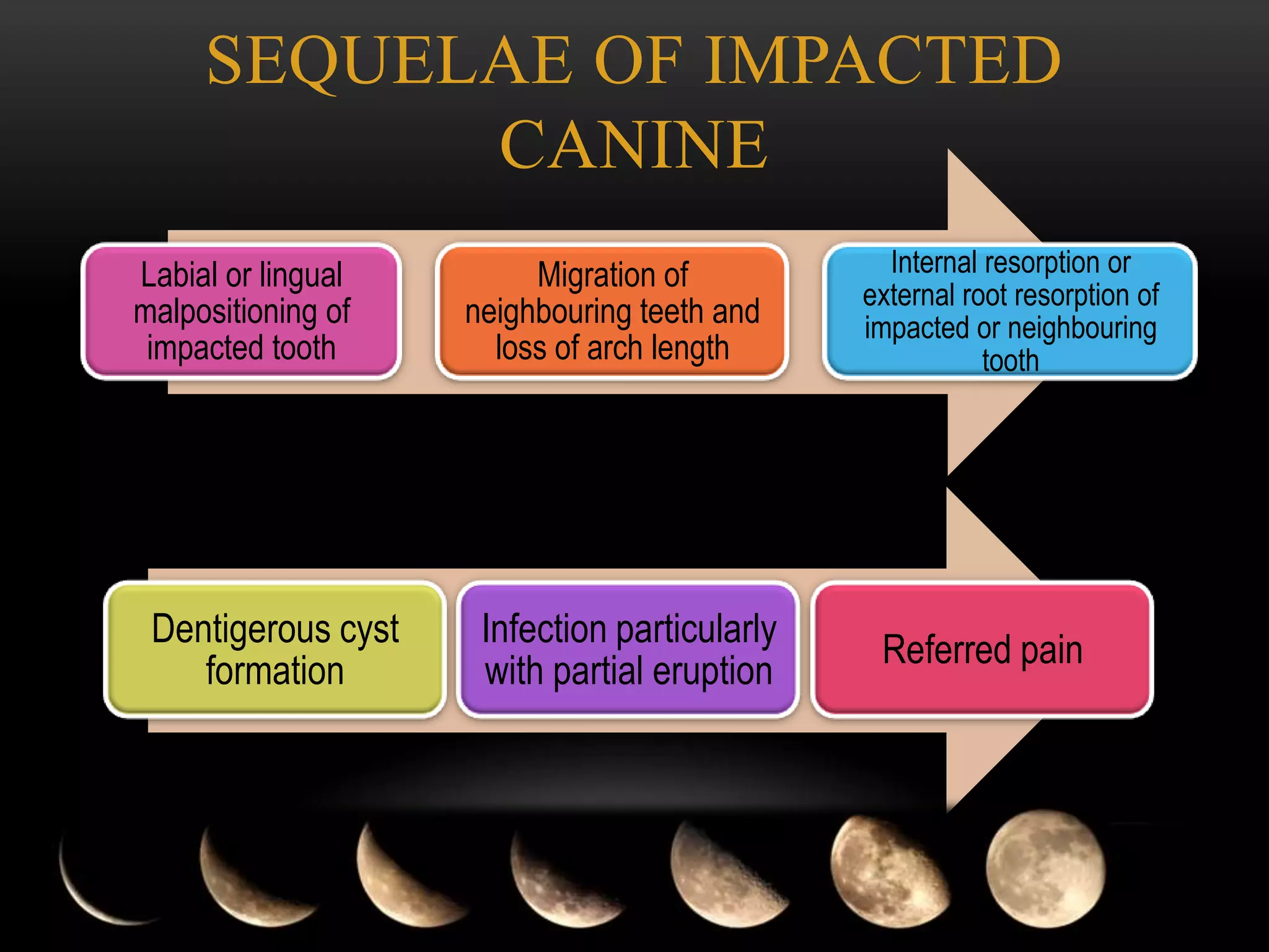 canine impaction | PPTX