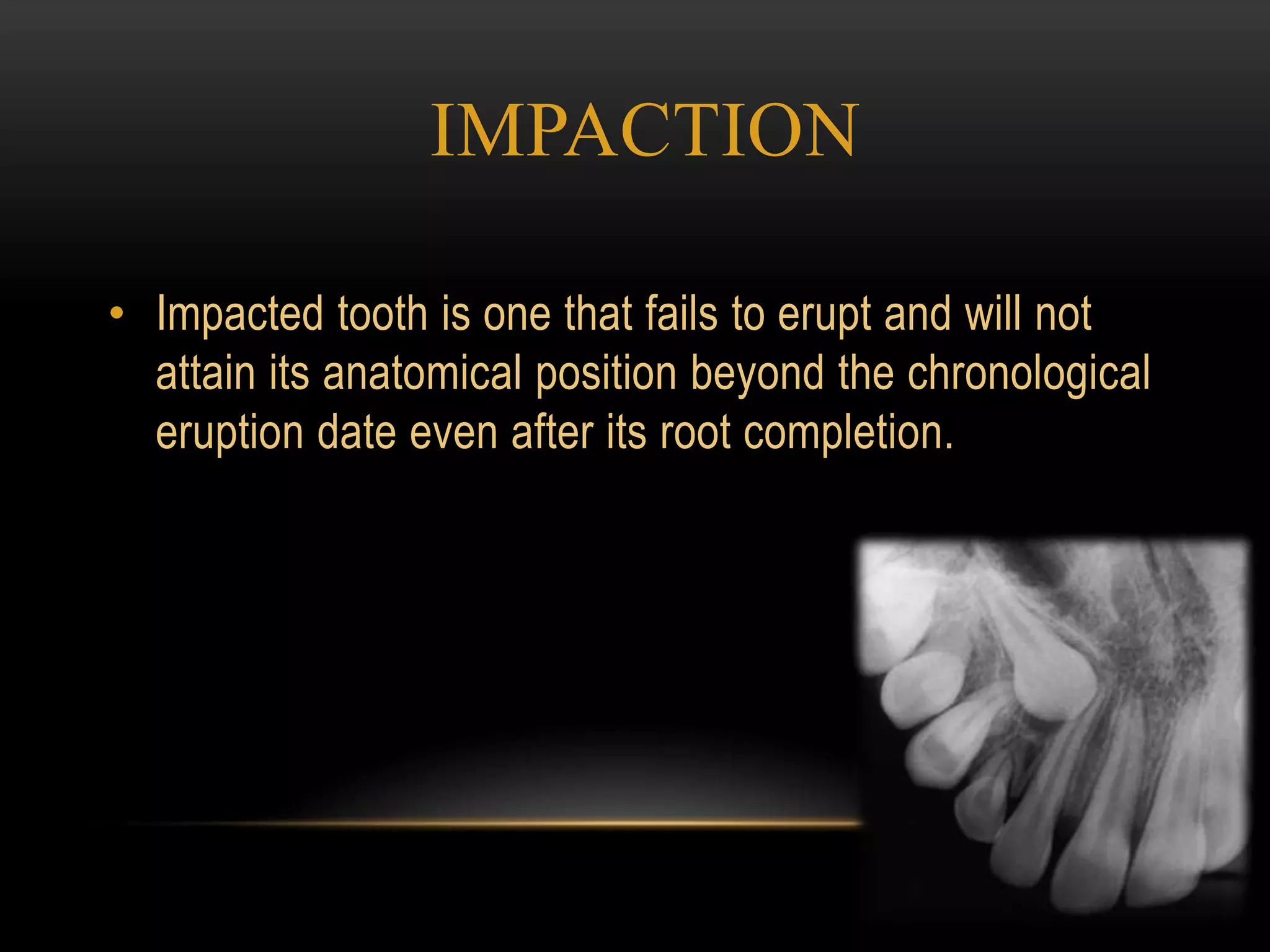 canine impaction | PPTX