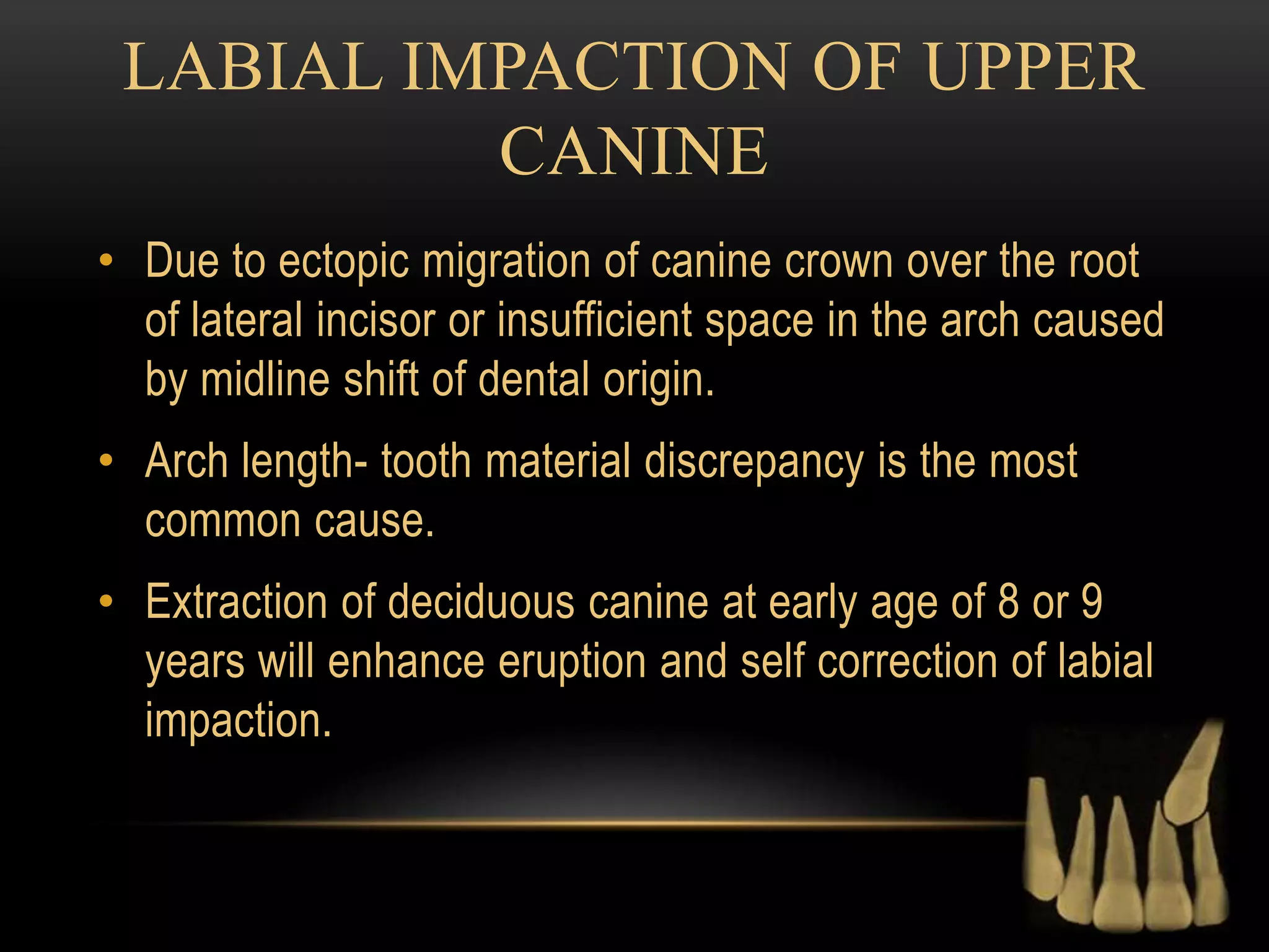 canine impaction | PPTX