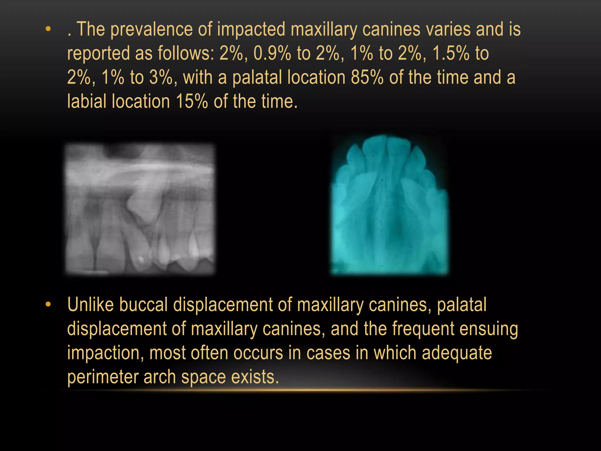 canine impaction | PPTX