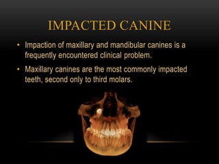canine impaction | PPTX