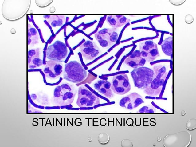 STAINING TECHNIQUES AND TYPES PROCEDURE. | PPTX | Chemistry | Science