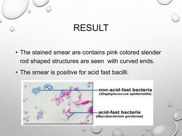 STAINING TECHNIQUES AND TYPES PROCEDURE. | PPTX | Chemistry | Science