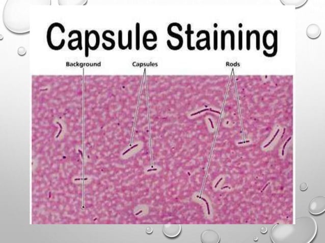 STAINING TECHNIQUES AND TYPES PROCEDURE. | PPTX | Chemistry | Science
