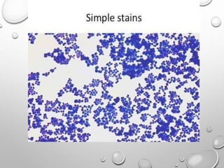 STAINING TECHNIQUES AND TYPES PROCEDURE. | PPTX | Chemistry | Science