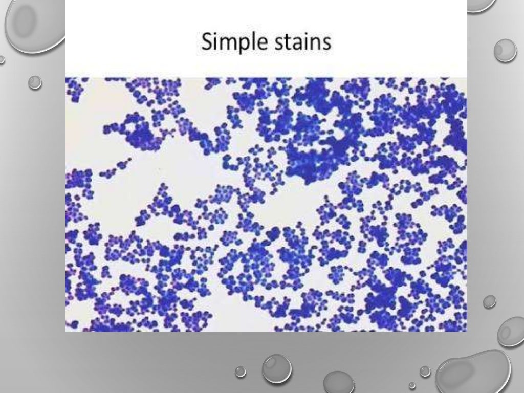 STAINING TECHNIQUES AND TYPES PROCEDURE.