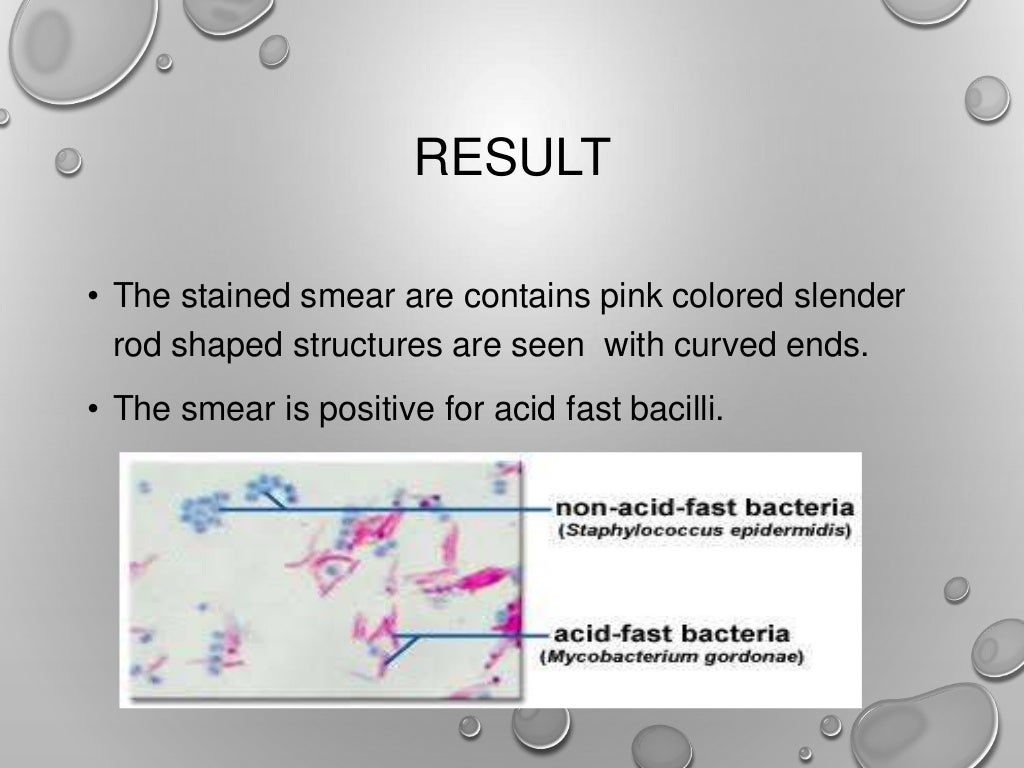 STAINING TECHNIQUES AND TYPES PROCEDURE.