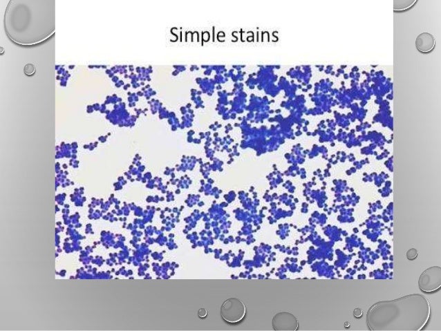 STAINING TECHNIQUES AND TYPES PROCEDURE.