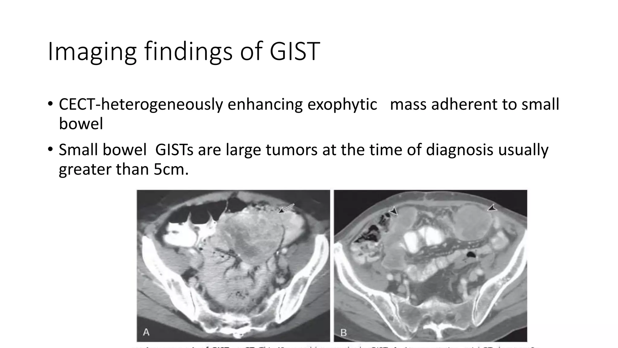 SMALL INTESTINE RADIOLOGY | PPTX