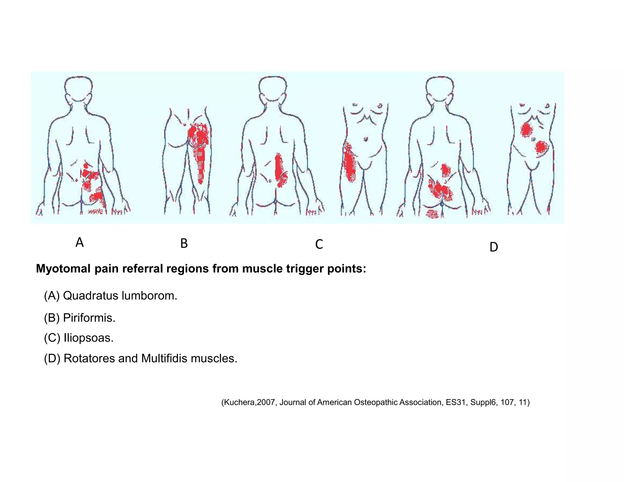 Sacroiliac(SI) Joint Dysfunction,Evaluation and Treatment | PDF