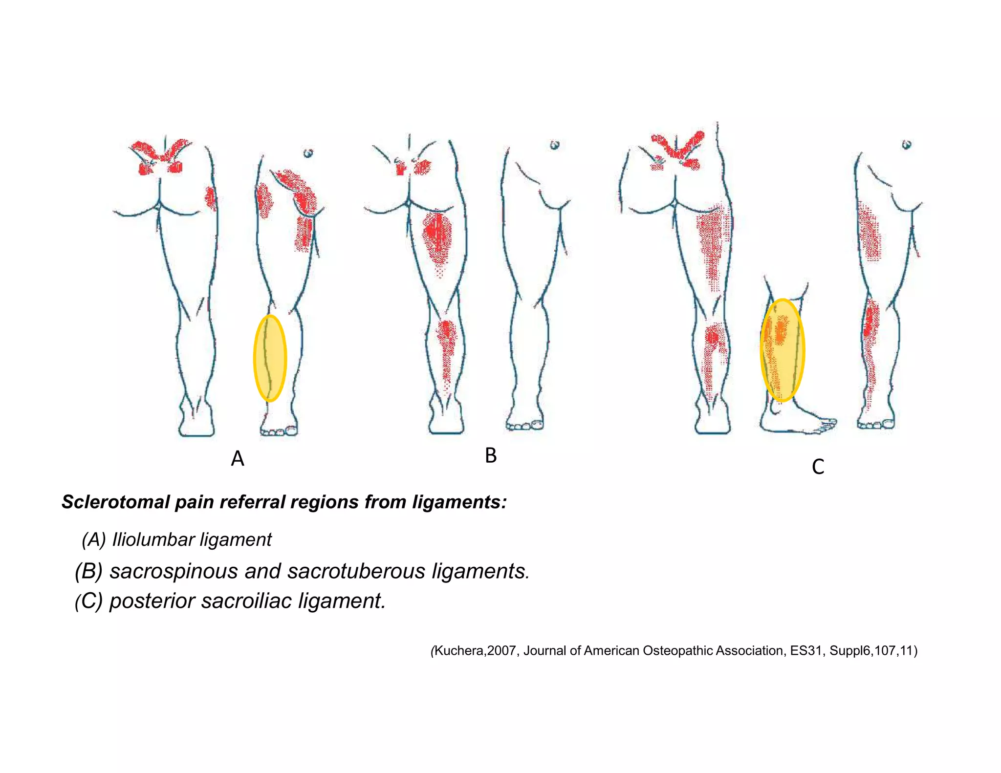 Sacroiliac(SI) Joint Dysfunction,Evaluation and Treatment | PDF