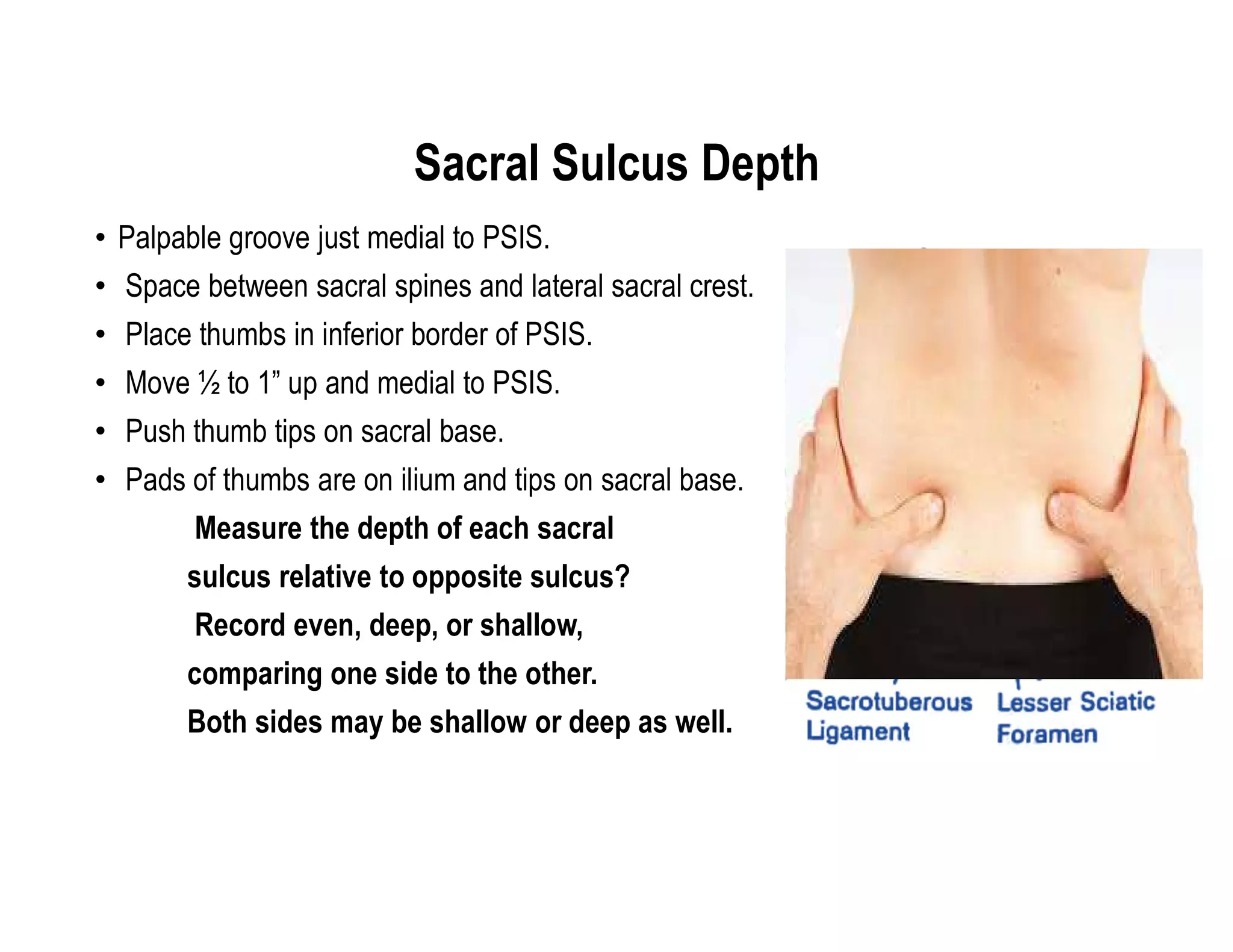 Sacroiliac(SI) Joint Dysfunction,Evaluation and Treatment | PDF